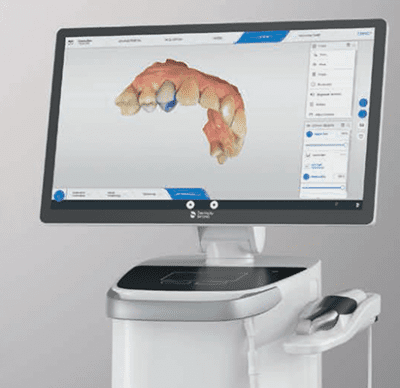 CEREC, Same Day Restorations in Gosford, 7 Days: VC Dental