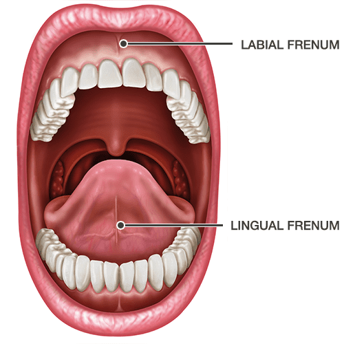 Lingual and Labial Frenectomy in Gosford: VC Dental