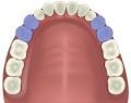 Tooth Anatomy - Gosford, Experienced Dentists: VC Dental