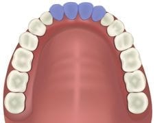 Tooth Anatomy - Gosford, Experienced Dentists: VC Dental