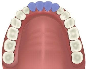 Tooth Anatomy - Gosford, Experienced Dentists: VC Dental