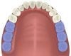 Tooth Anatomy - Gosford, Experienced Dentists: VC Dental