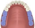 Tooth Anatomy - Gosford, Experienced Dentists: VC Dental